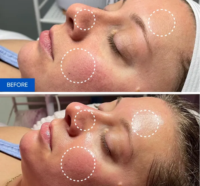 Eternal Glow Revive Therapy Facial - Verve Medical Aesthetics - Facial ...